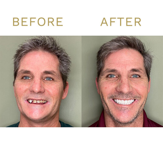 Dentist in Tinley Park, IL - Smile Gallery Tinley Park Smiles & Implant ...