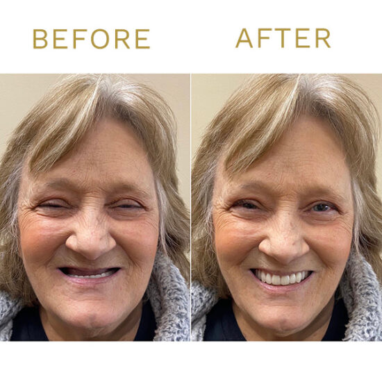 Dentist in Tinley Park, IL - Smile Gallery Tinley Park Smiles & Implant ...